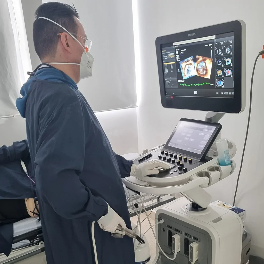 Ecocardiograma transesofágico - Cardio Colombia